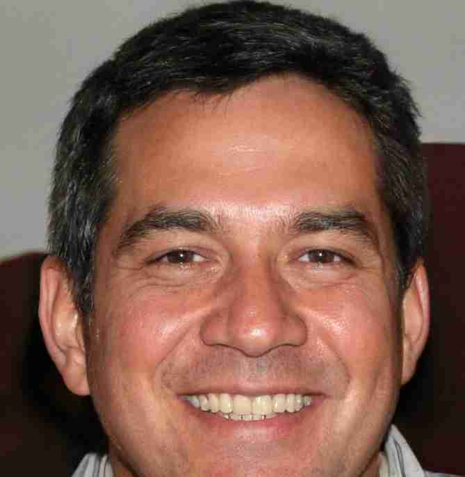 Engrasadora Automática Colombia - HYMA